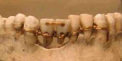 Ancient Egyptian Dentistry - DentalSave Dental Plans