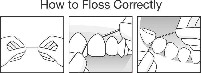How to Floss Your Teeth - DentalSave Dental Plans